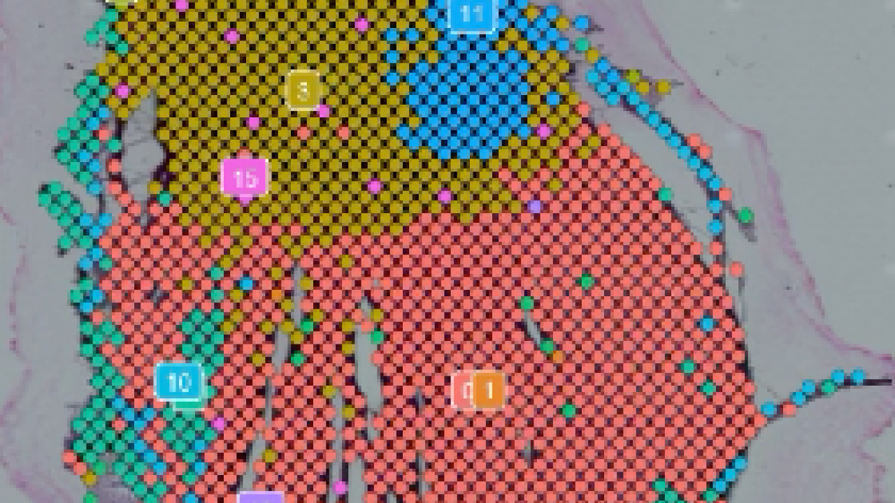 UC Davis Bioinformatics Core: Advance Single-Cell RNA-Seq Analysis ...